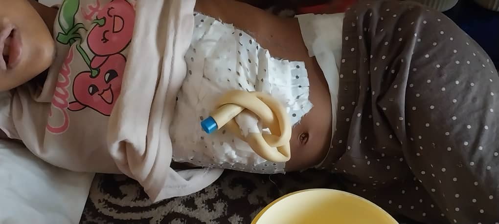 SOS pour Saran Diallo dont la vie est en danger après avoir bu de la ...